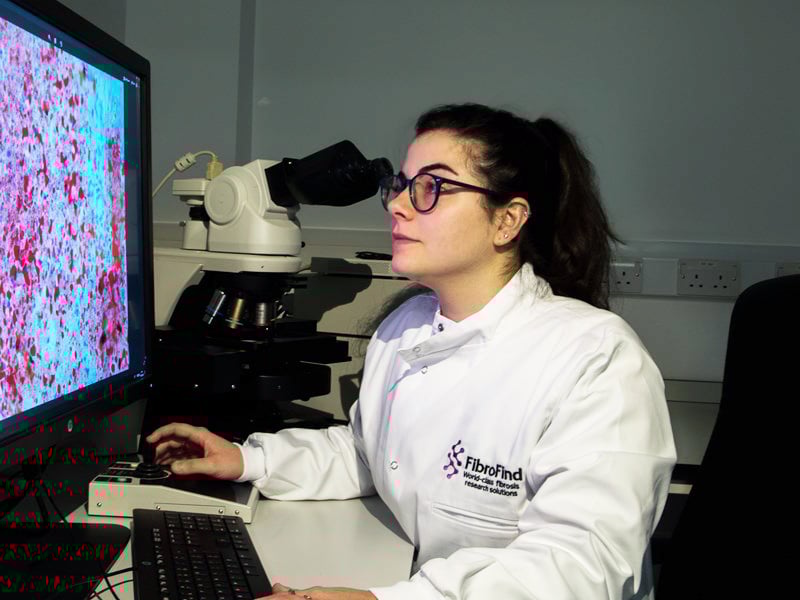 Biocair helps FibroFind fast-track vital fibrosis drug development