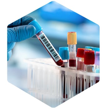 Lab Logistics Solutions | Biocair